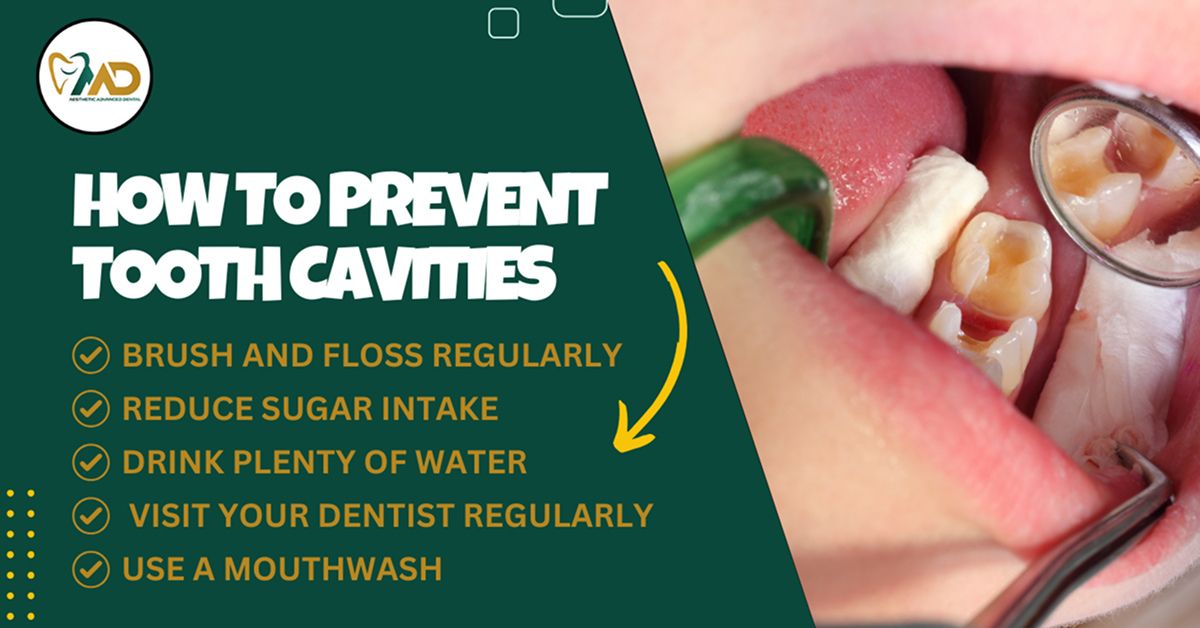 How Tooth Cavities Form & Best Prevention Tips for Healthy Teeth
